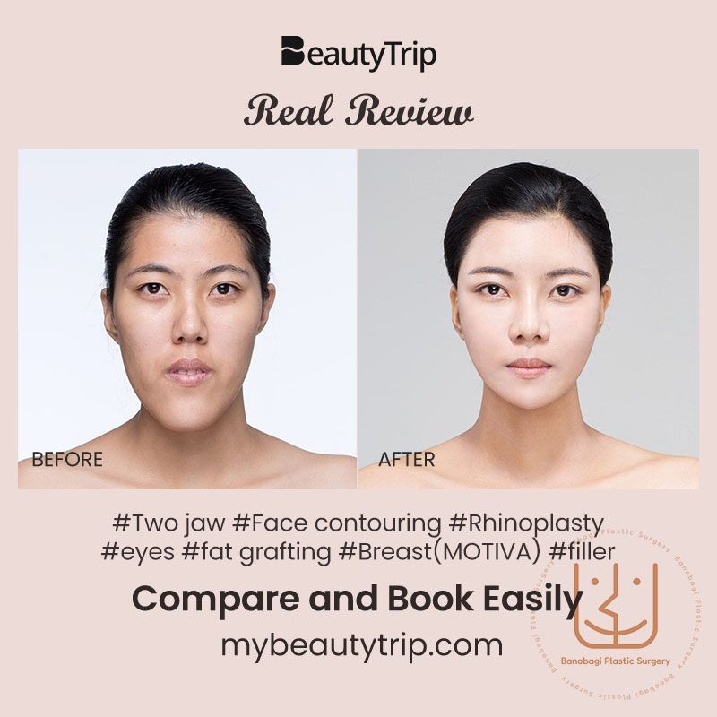 contouring face surgery